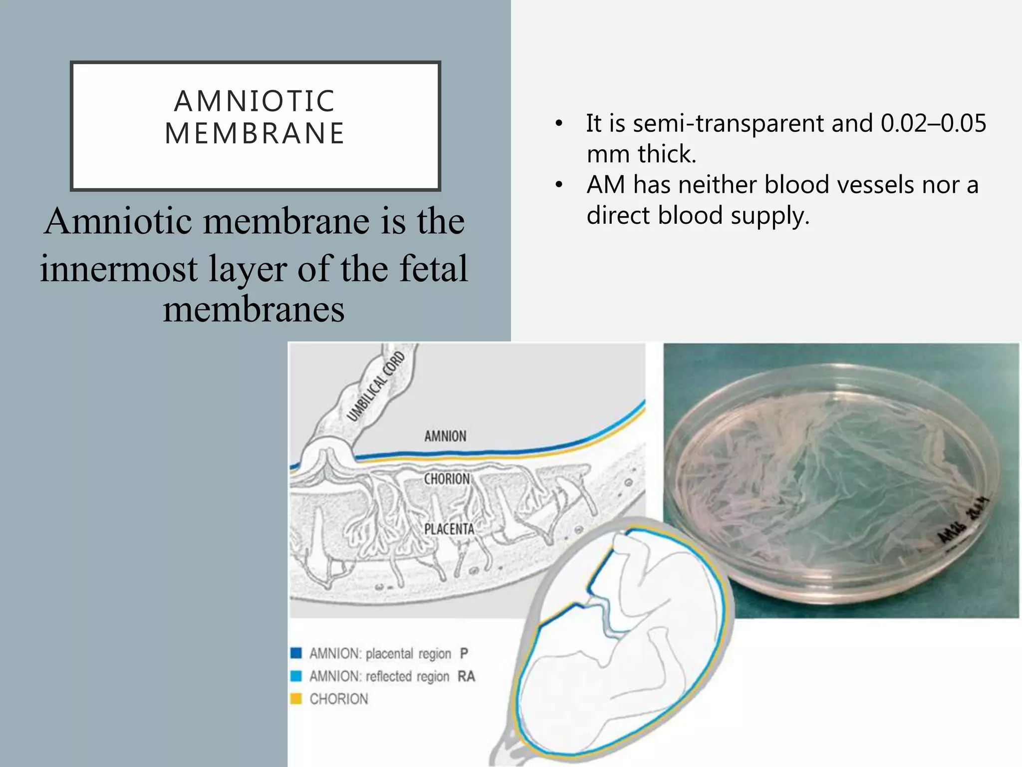 Amniotic membrane in ophthalmology | PPTX
