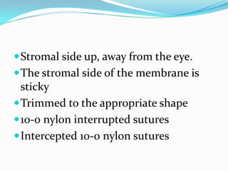Amniotic Membrane Transplant | PPTX