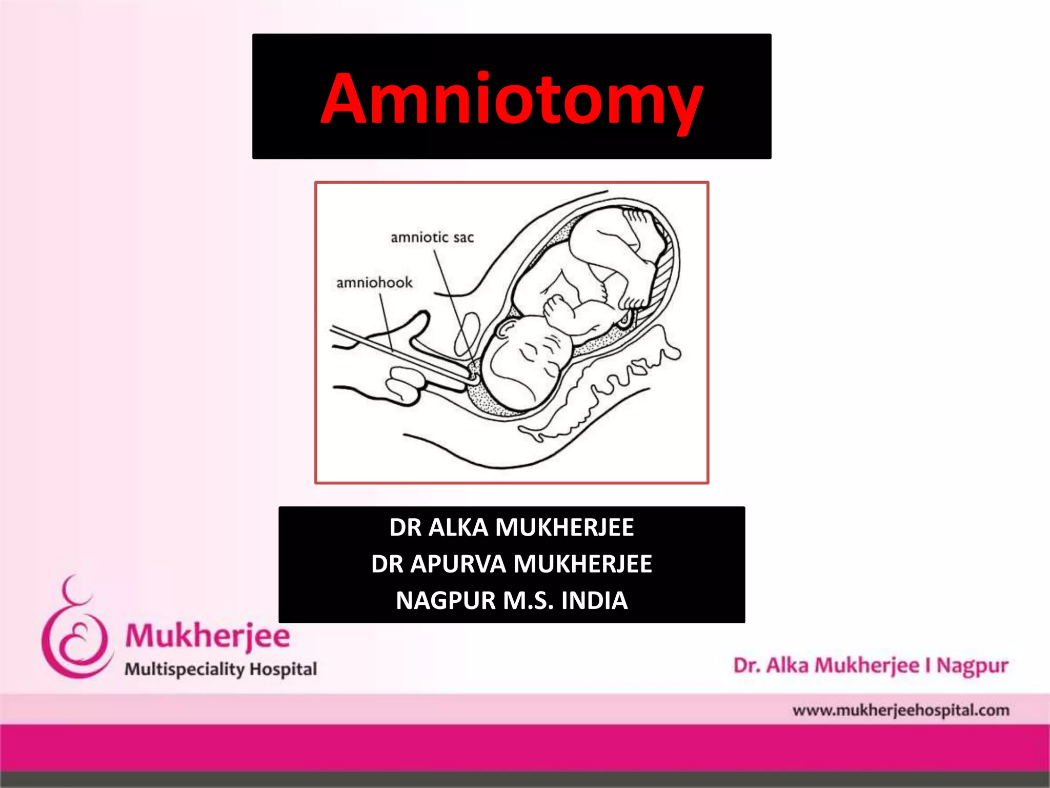 Amniotomy by dr alka mukherjee dr apurva mukherjee nagpur m.s. india | PPTX