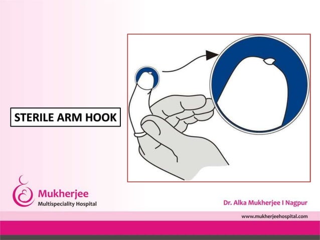 Amniotomy by dr alka mukherjee dr apurva mukherjee nagpur m.s. india ...