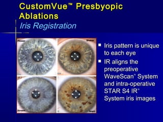 Amo presbyopia training course | PPT