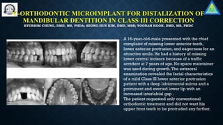 A Modified C-Implant for Simpler and More Efficient.pdf