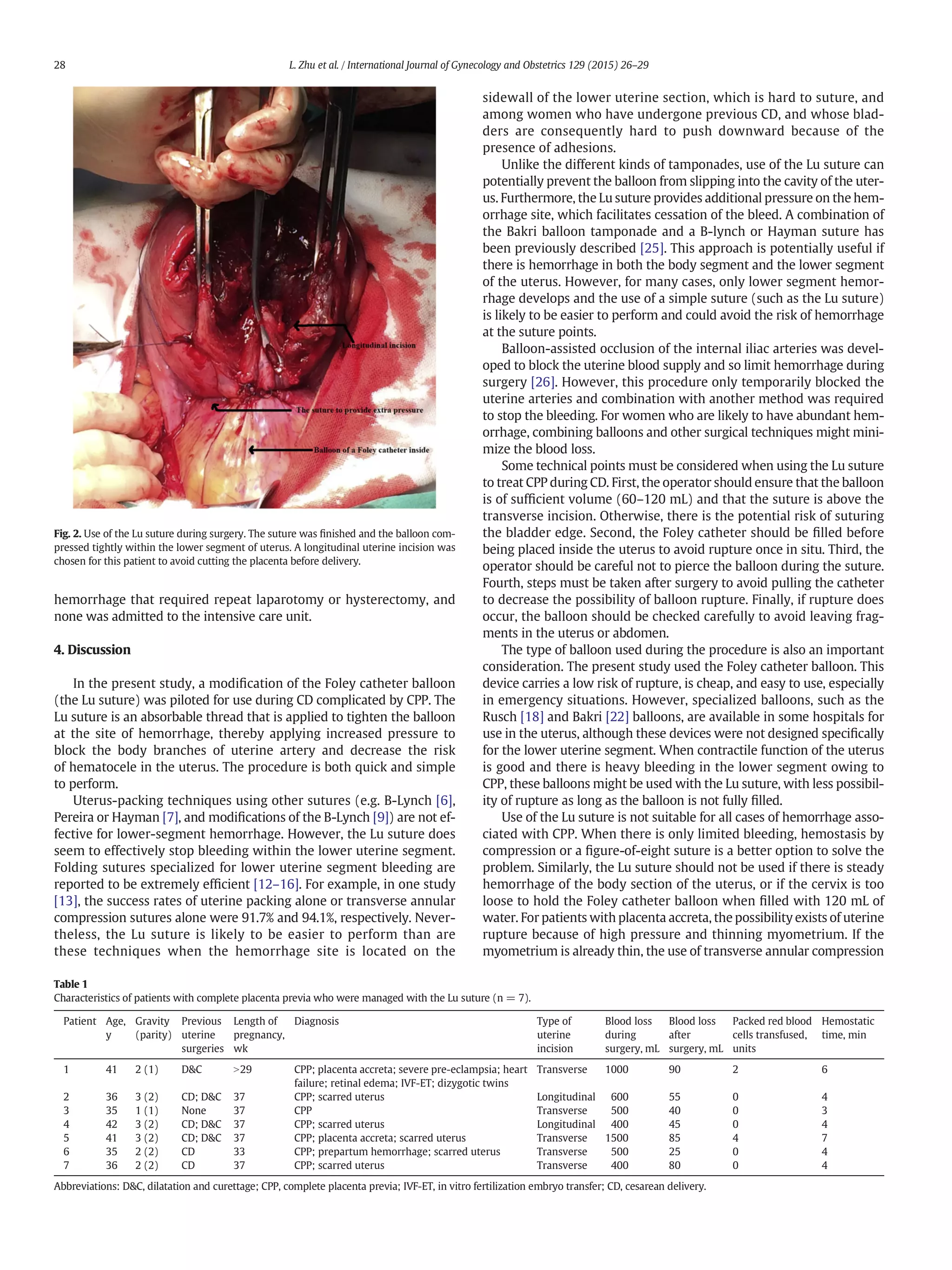 A modified suture technique for hemorrhage during cesarean delivery ...