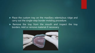 A MODIFIED TECHNIQUE FOR SINGLE STEP BORDER MOLDING.pptx