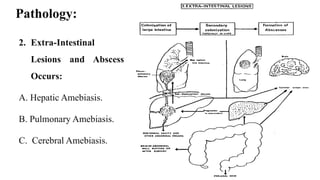 AMOEBAS INFECTING MOUTH AND INTESTINE.pptx