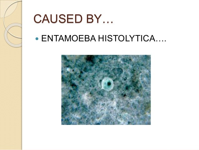 Amoebiasis