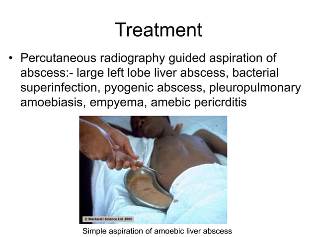 Amoebiasis | PPTX | Digestive Disorders | Diseases and Conditions