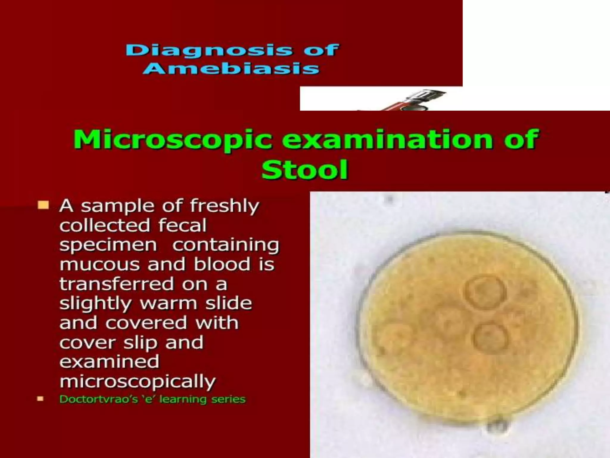 Amoebiasis | PPT