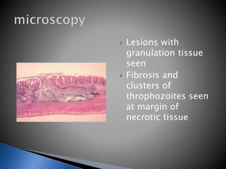 Amoebiasis pathogenesis and pathology | PPTX