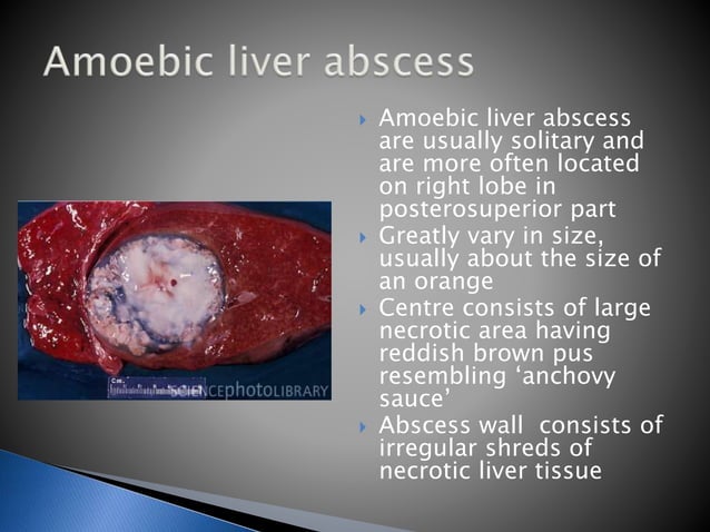 Amoebiasis pathogenesis and pathology | PPTX | Digestive Disorders ...