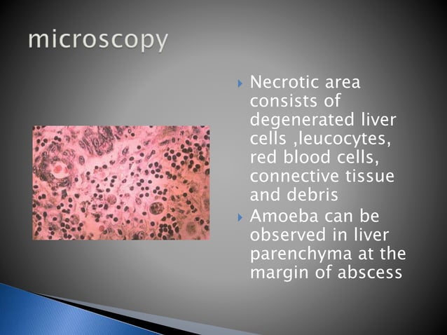 Amoebiasis pathogenesis and pathology | PPT
