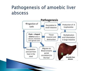 Amoebiasis 22 | PPT