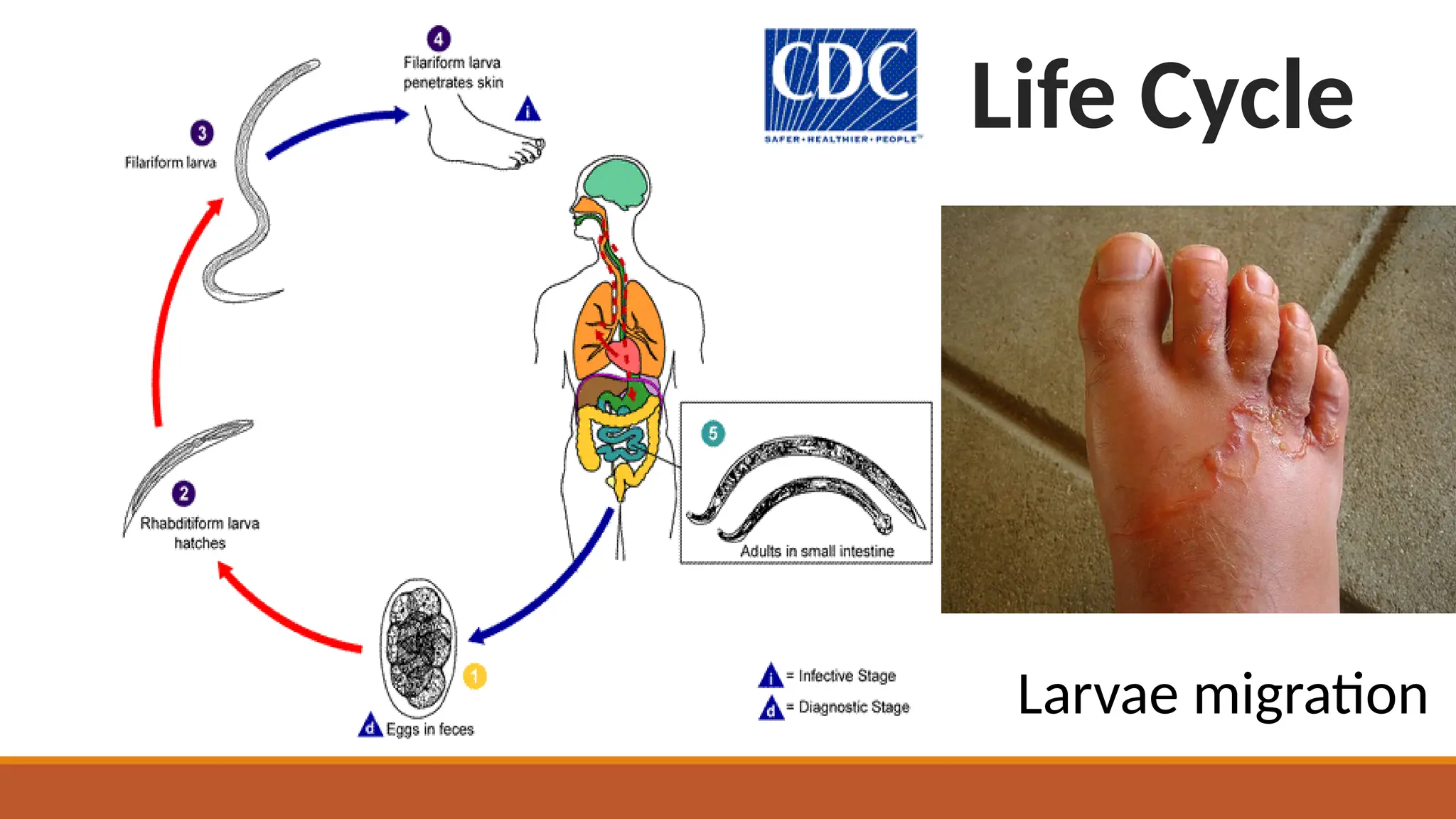 Amoebiasis, Ascariasis and Hookworm infection .pptx