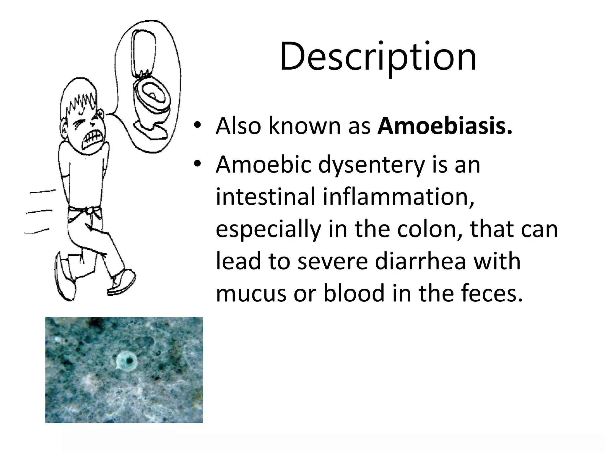 Amoebiasis report | PPTX
