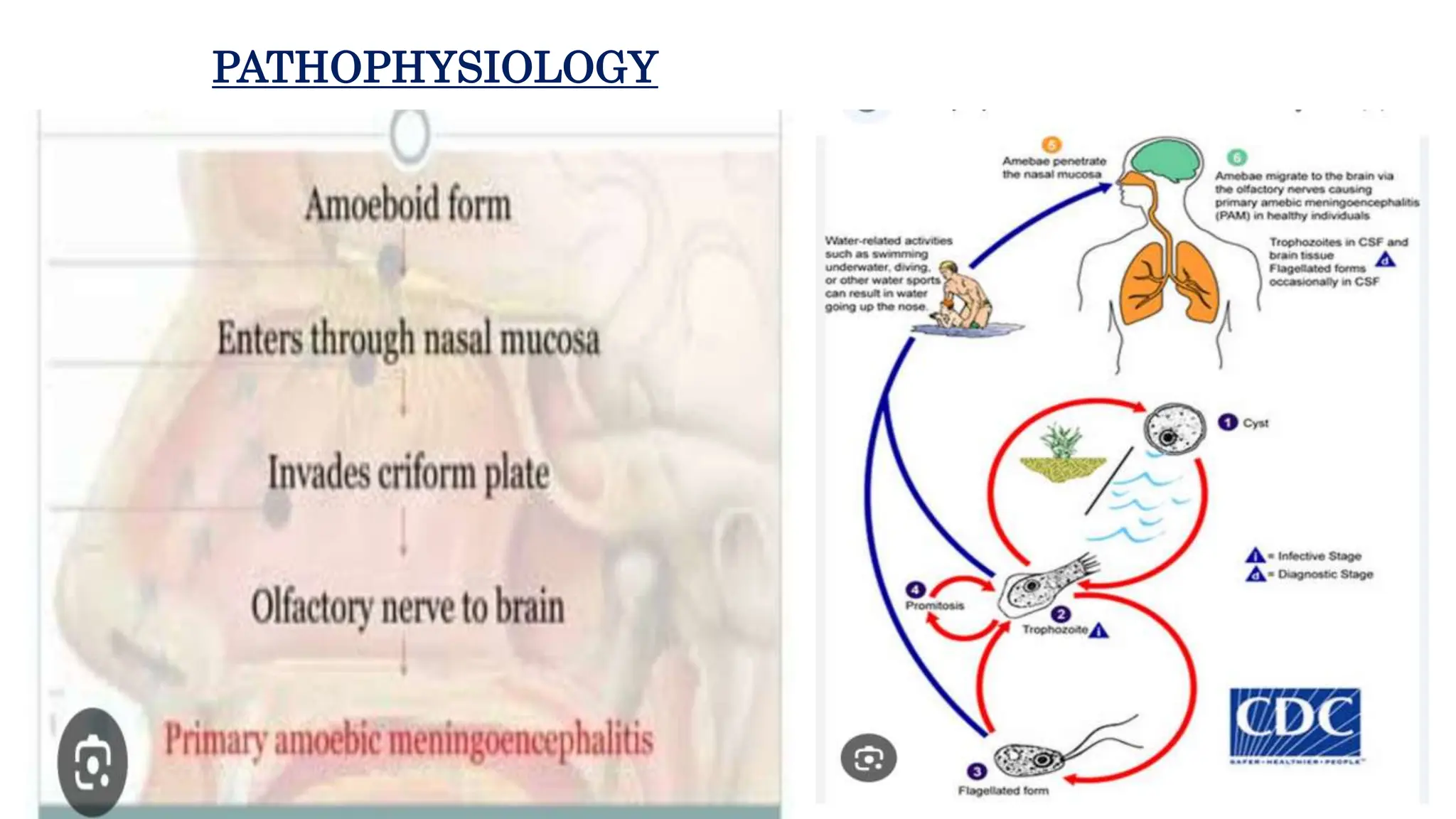 Amoebic meningitis : Brief about the disease | PPTX