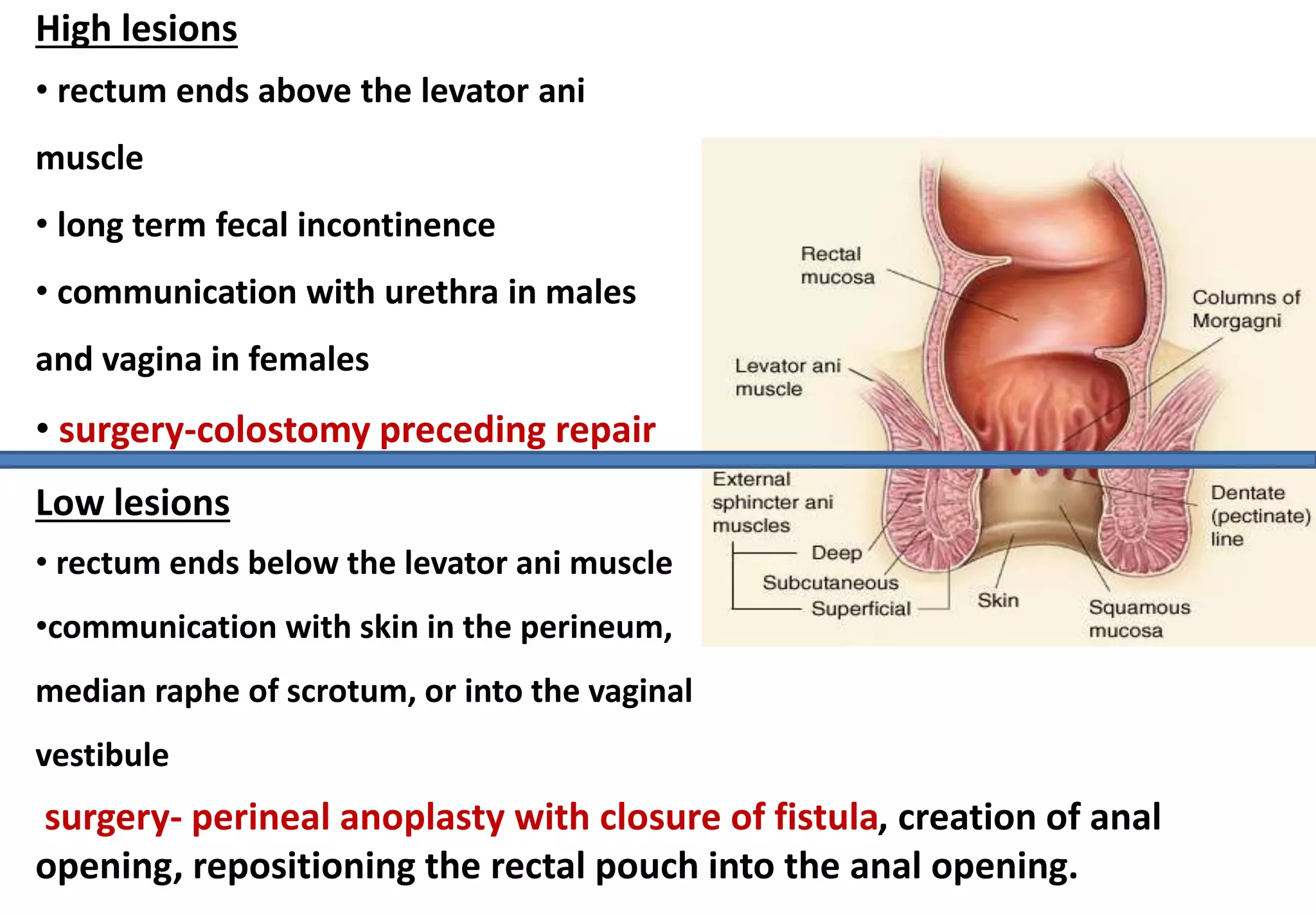 Anesthetic management in ARM, Intestinal obstruction and Duodenal ...
