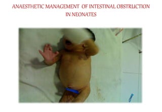 Anesthetic management in ARM, Intestinal obstruction and Duodenal ...
