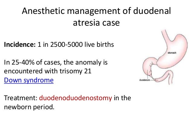 Anesthetic Management In Arm Intestinal Obstruction And Duodenal Atr