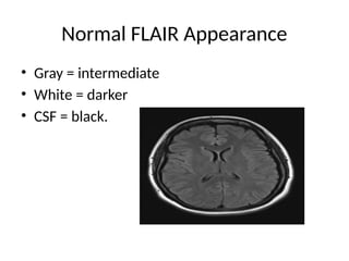 mri brain with diffrent images and types of mri | PPTX