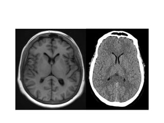 mri brain with diffrent images and types of mri | PPTX