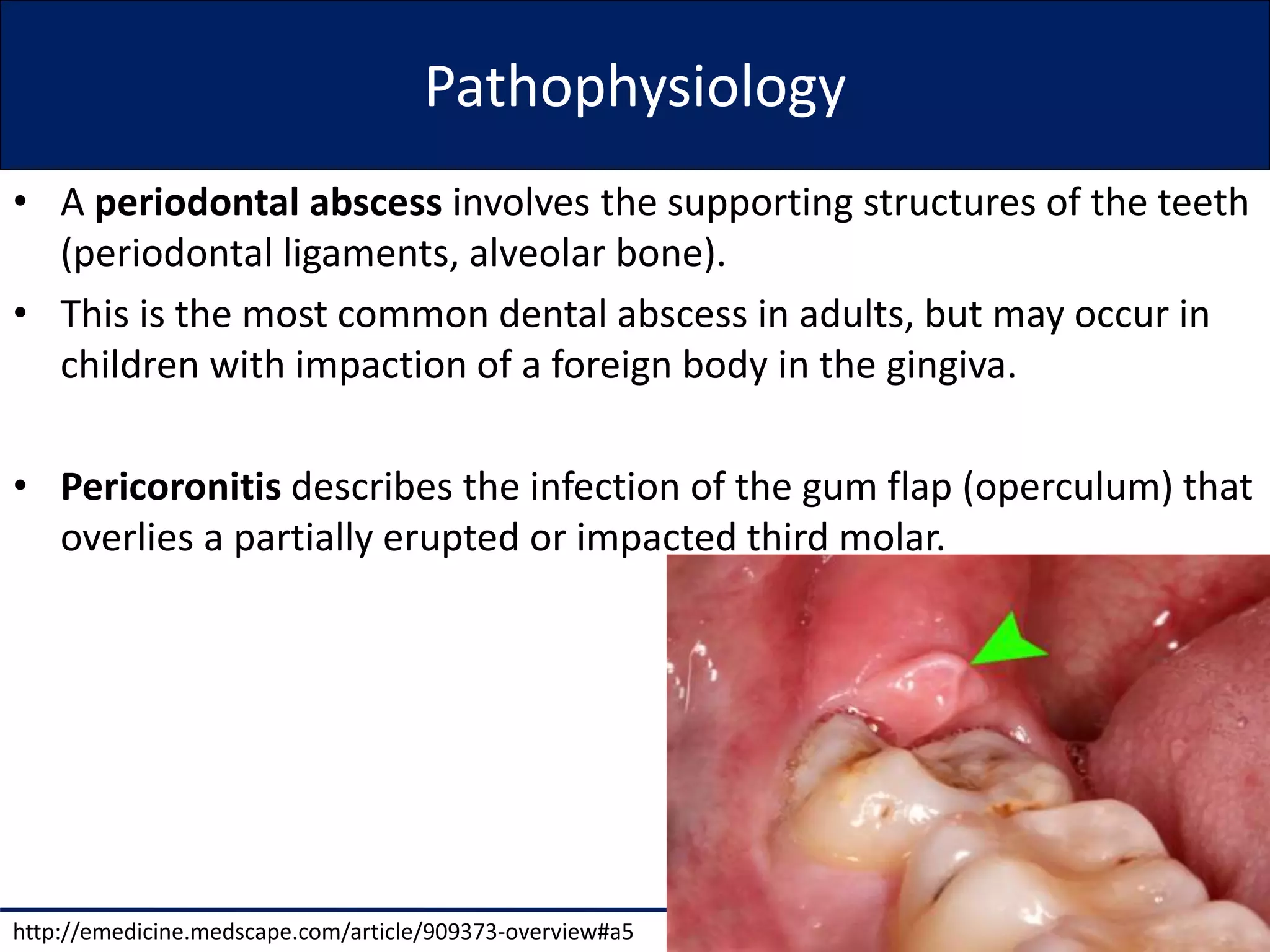 Amoxicillin in dentistry | PPTX