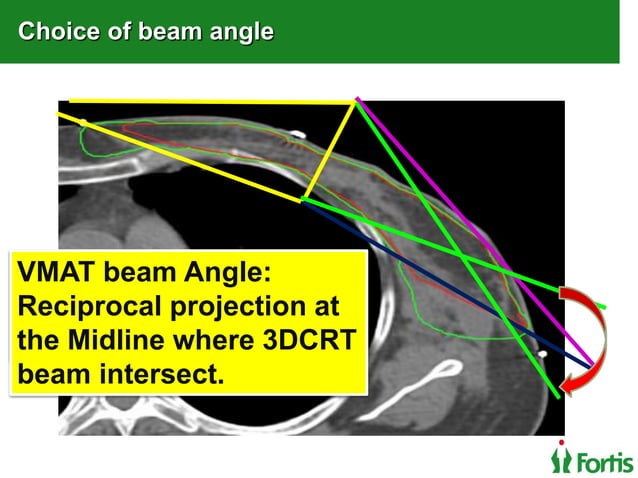 Past, present and future of radiotherapy technique in different sites ...