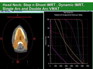 Past, present and future of radiotherapy technique in different sites ...