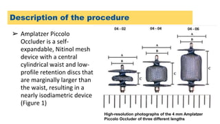 Amplatzer Piccolo Occluder clinical trial_19072022.pptx