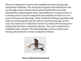 Amplification device | PPTX