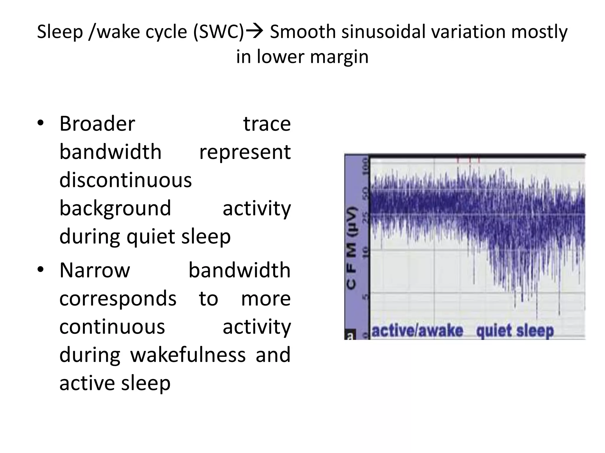 Amplitude integrated eeg in neonates | PPTX