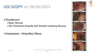AMPULLARY ADENOMA CASE - BASED DISCUSSION | PPTX