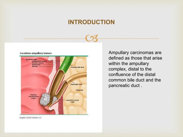 Ampullary carcinoma | PPTX | Cancer | Diseases and Conditions