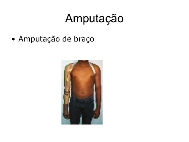Amputacao