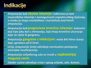Amputacije | PPSX