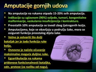 Amputacije | PPSX