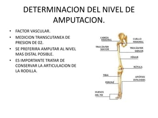 AMPUTACION INFRACONDILEA. PARTE 2.pptx