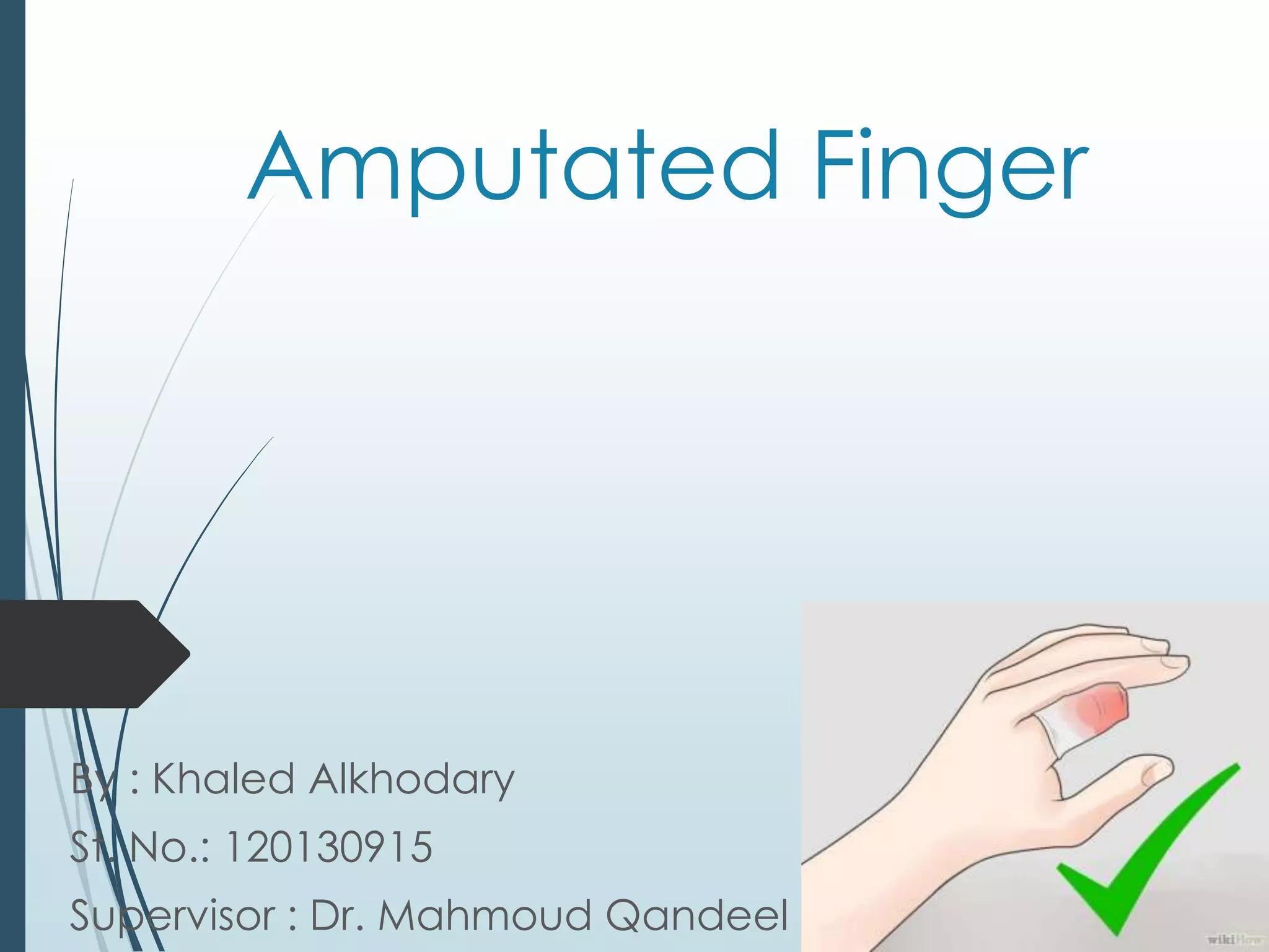 Amputated finger | PPTX