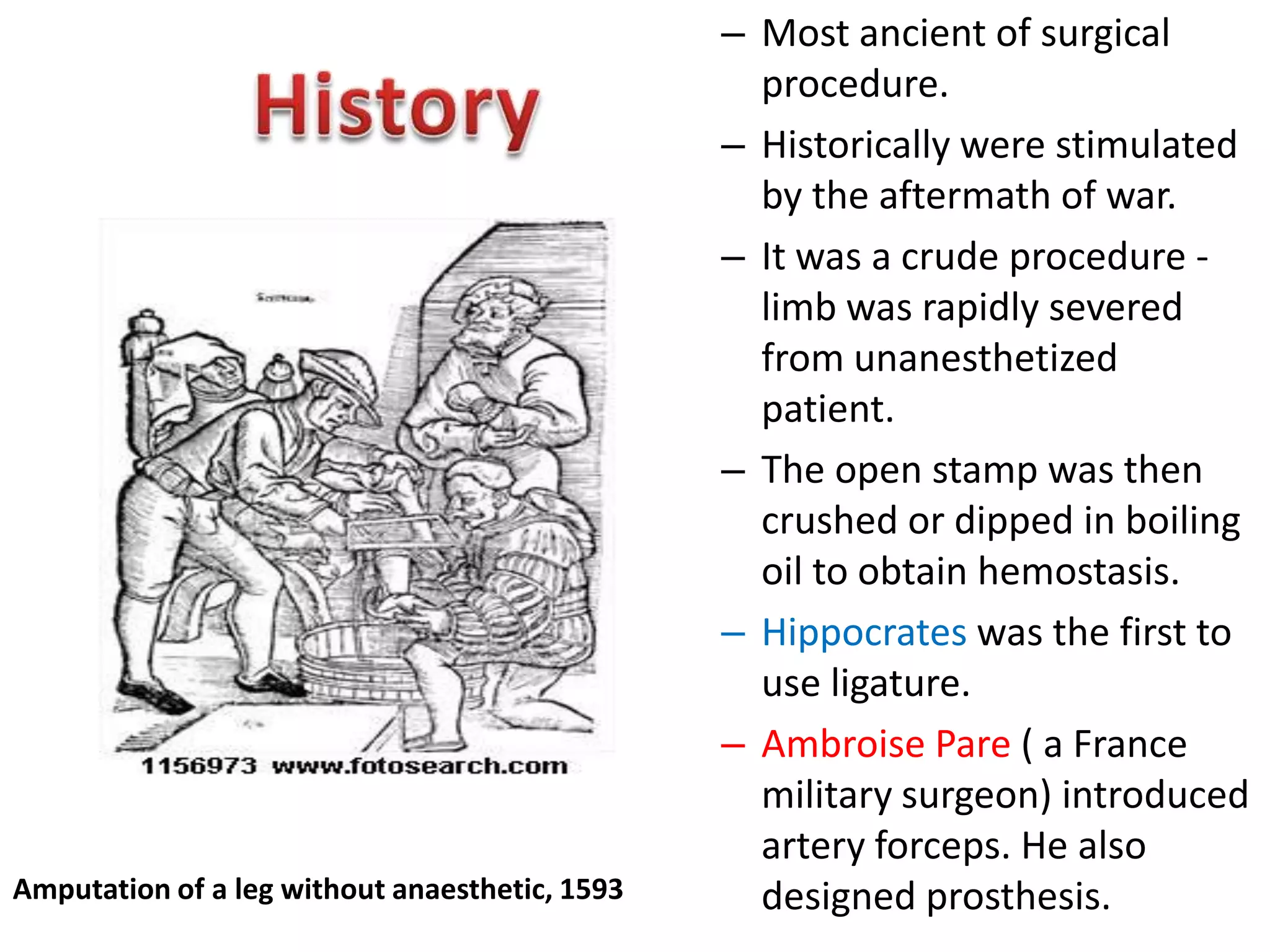 Amputation | PPTX