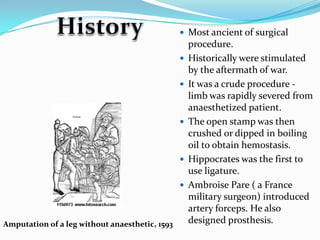 Amputation | PPTX