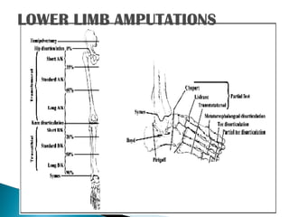 Amputation | PPT