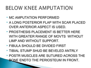 Amputation | PPT
