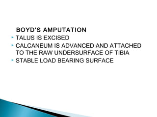 Amputation | PPT