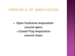 Amputation | PPTX