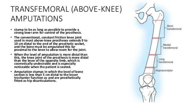 Below Knee Amputation Anatomy