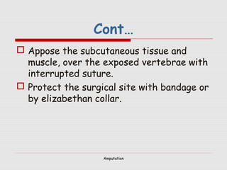 Amputation | PPT