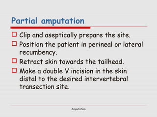 Amputation | PPT