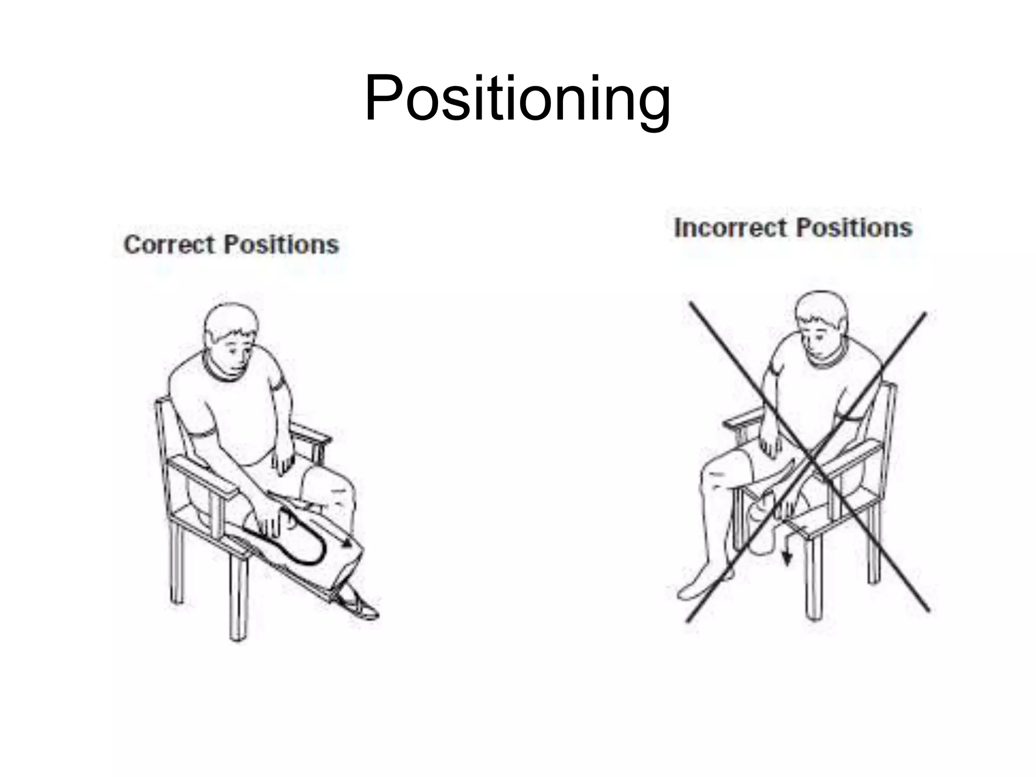 Amputation | PPTX