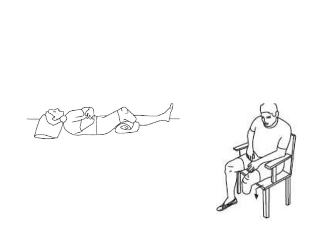 Amputation | PPTX