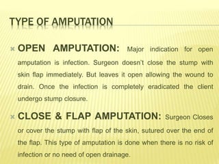 Amputation | PPTX
