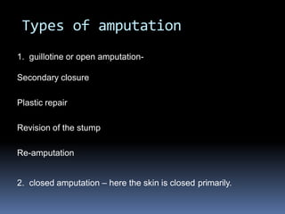 Amputation | PPTX